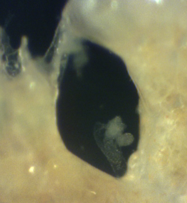 Living coral (outer reef) zone